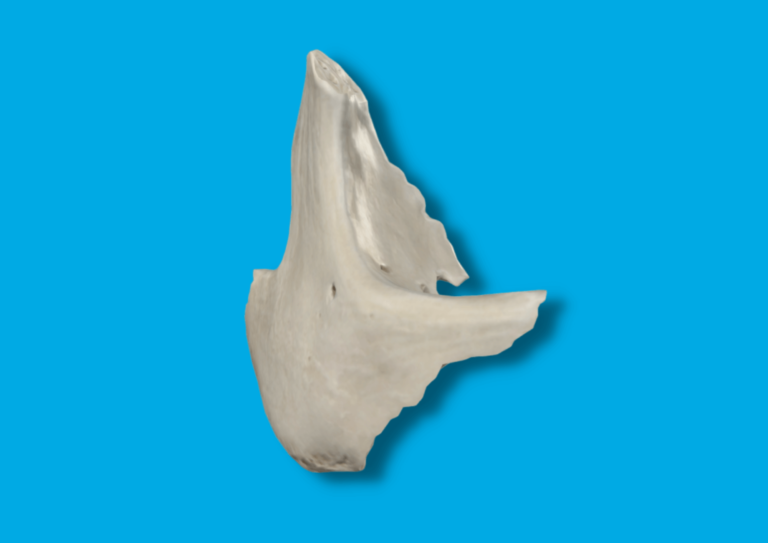 ️ Hueso Cigomático | HUESOS CUERPO HUMANO